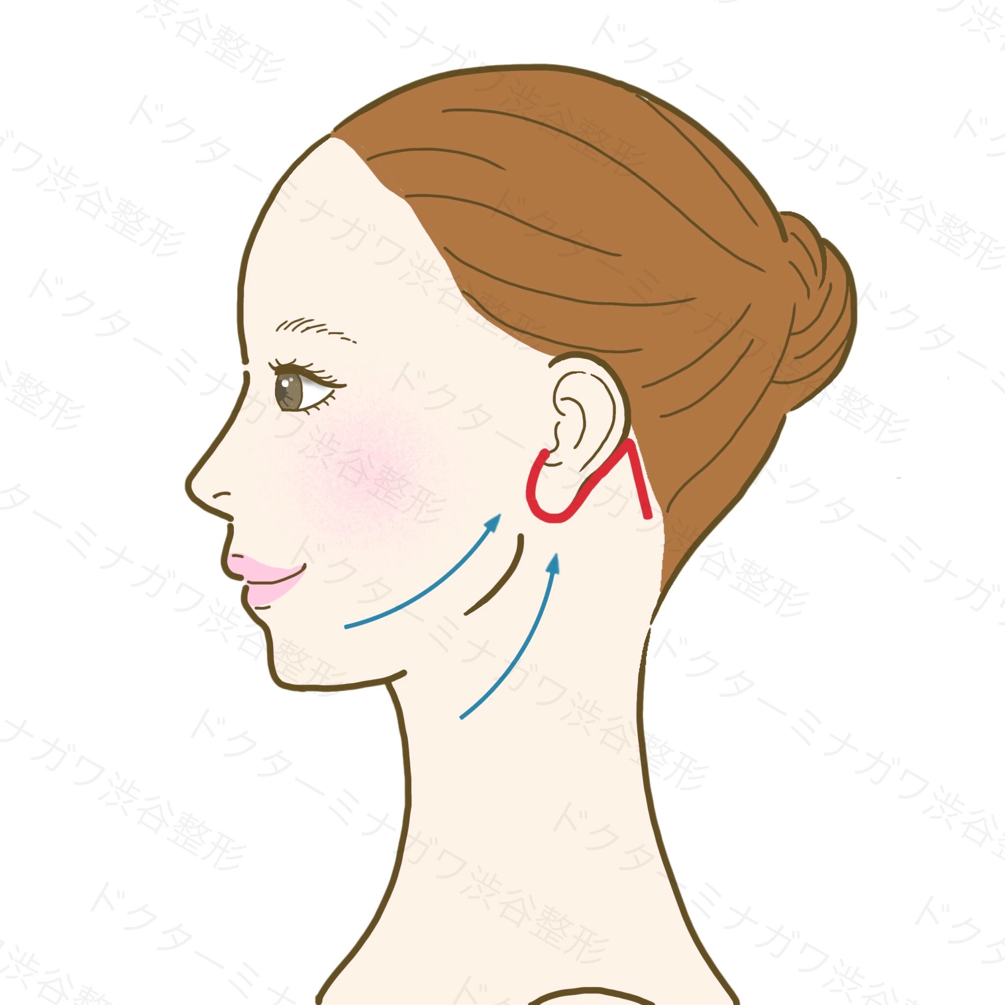 SMASとは？本格フェイスリフトで“たるみ戻り”を防ぐメカニズムとは - 渋谷の美容外科・美容整形クリニック | ドクターミナガワ渋谷整形